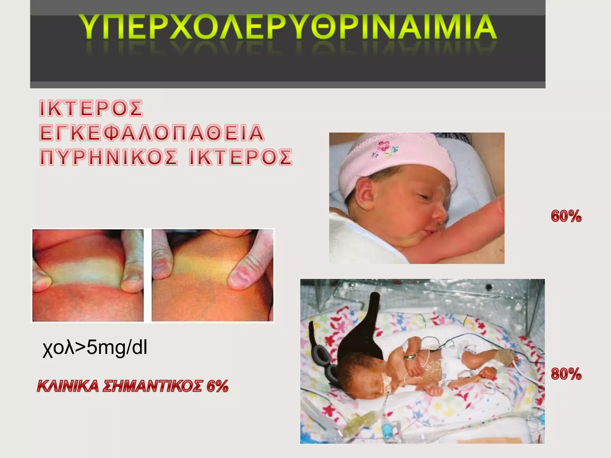 Νεογνικός Ίκτερος | PPT