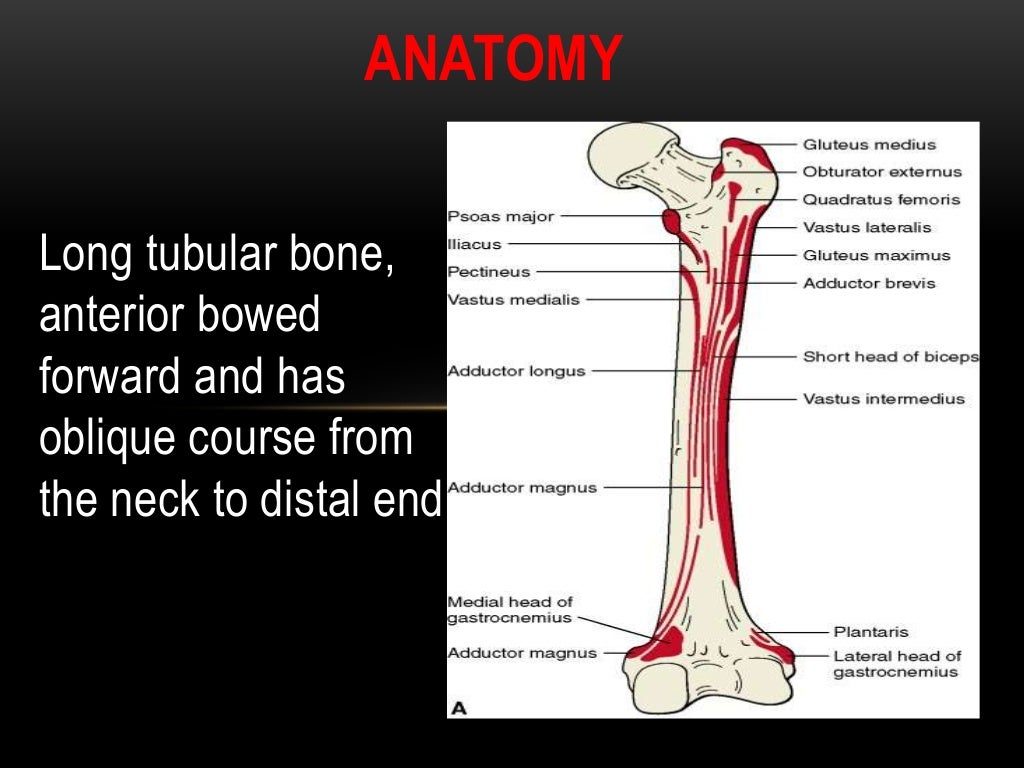 femoral shaft fracture