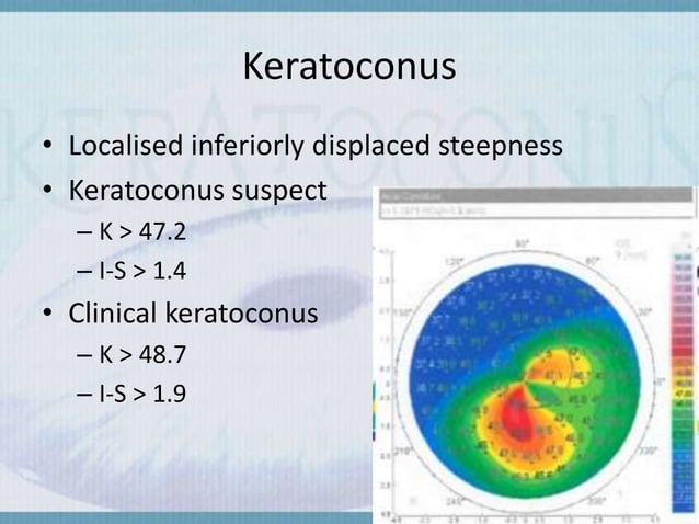 keratoconus | PPT