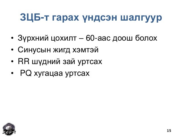 Зүрхний хэм алдагдал