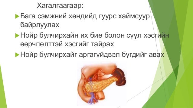 нойр булчирхай