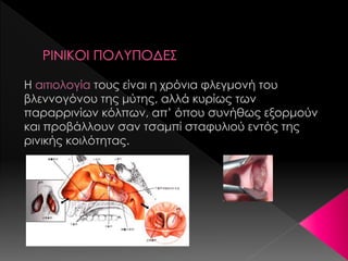 ΡΙΝΟΠΑΡΑΡΡΙΝΟΚΟΛΠΙΤΙΔΑ & ΡΙΝΙΚΟΙ ΠΟΛΥΠΟΔΕΣ | PPTX