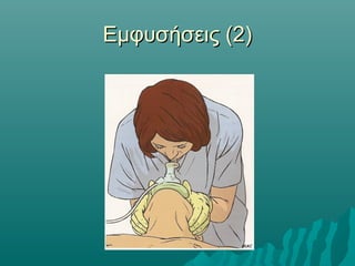 Βασικη Καρδιοαναπνευστικη Αναζωογονηση (ΚΑΡΠΑ) | PPT