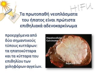 καρκίνος του ήπατος | PPSX