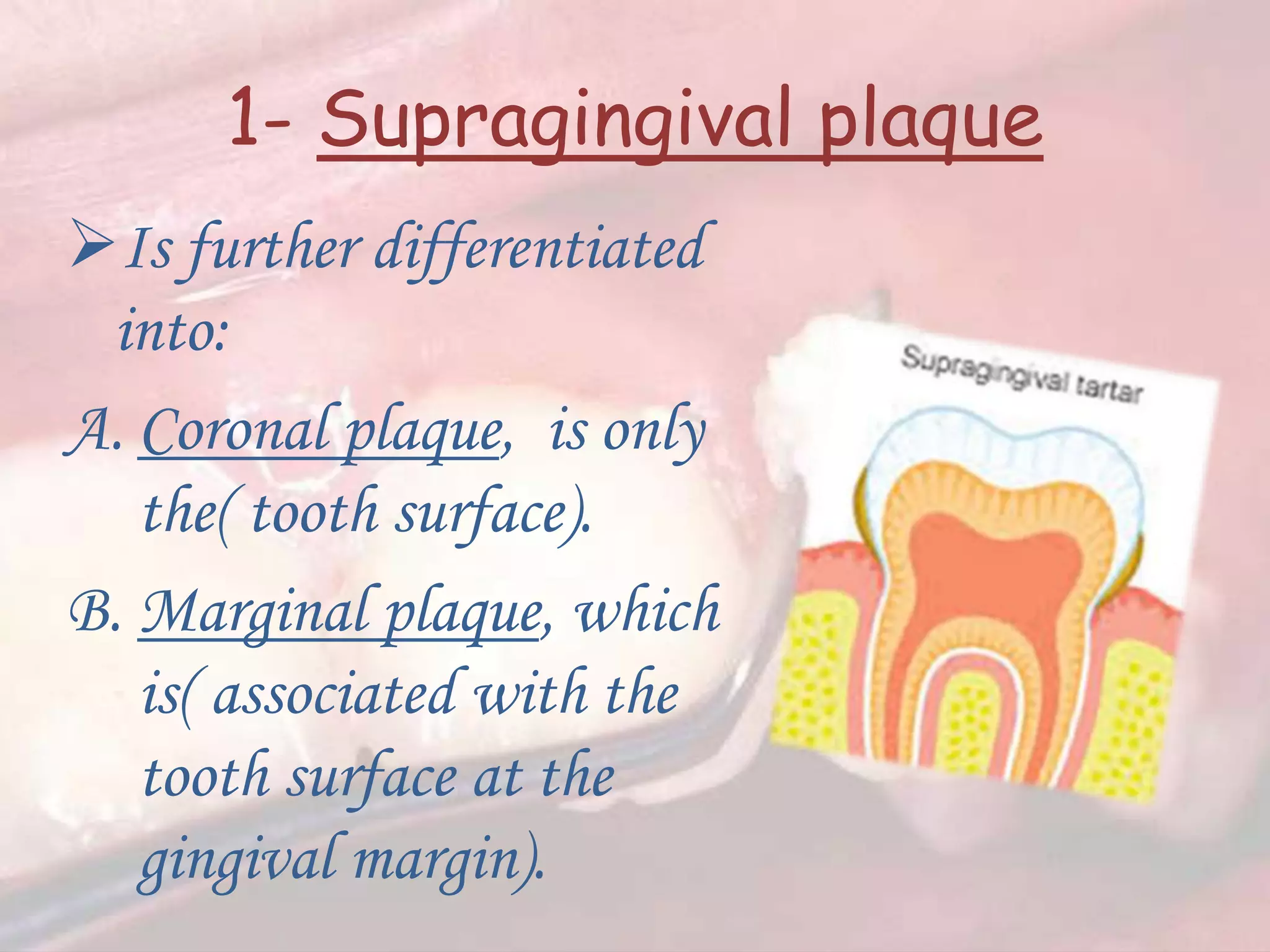 Dental plaque formation | PPTX