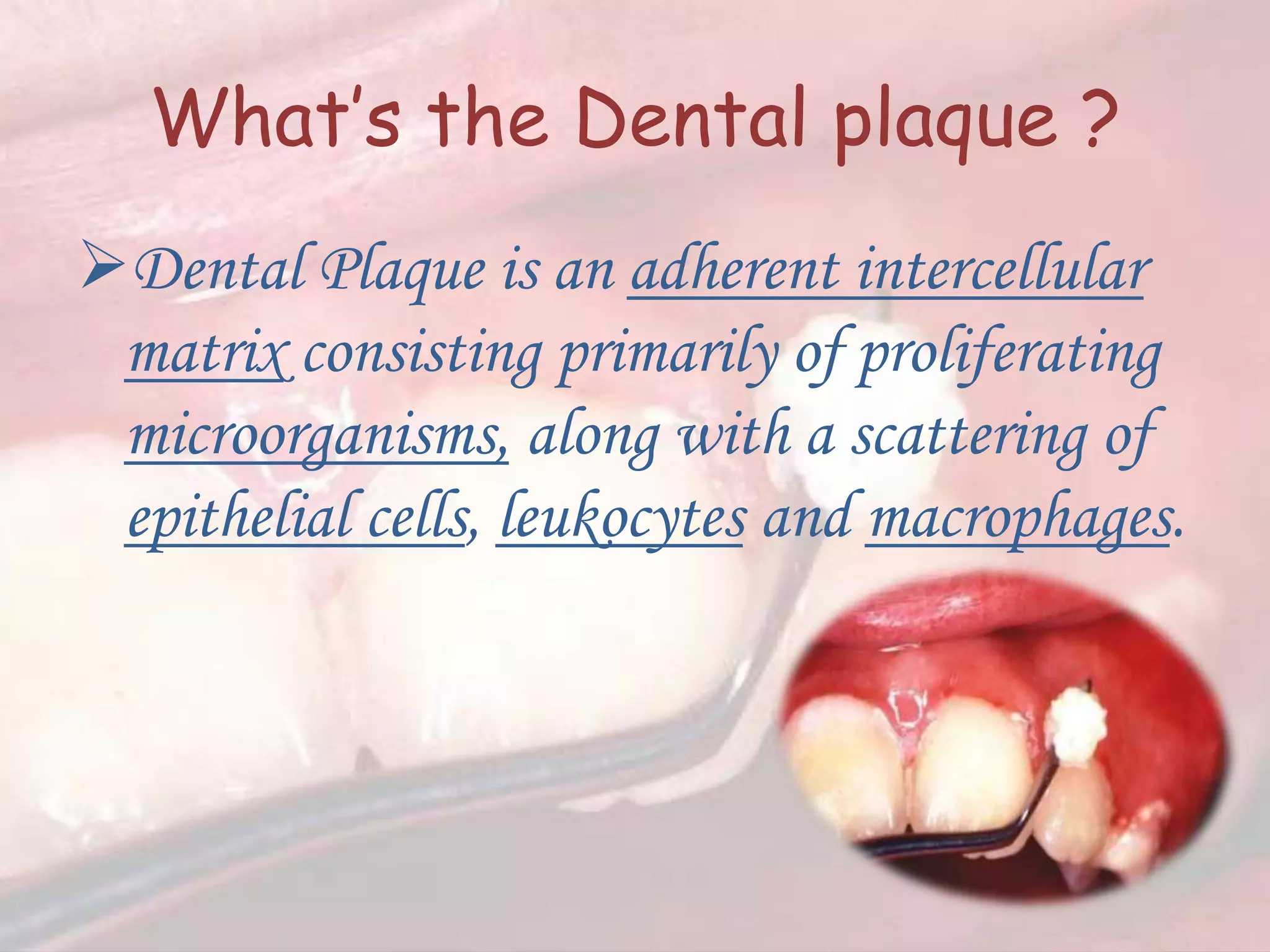 Dental plaque formation | PPTX