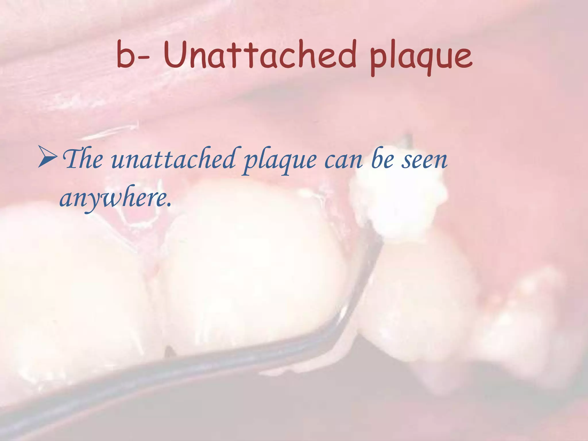 Dental plaque formation | PPTX