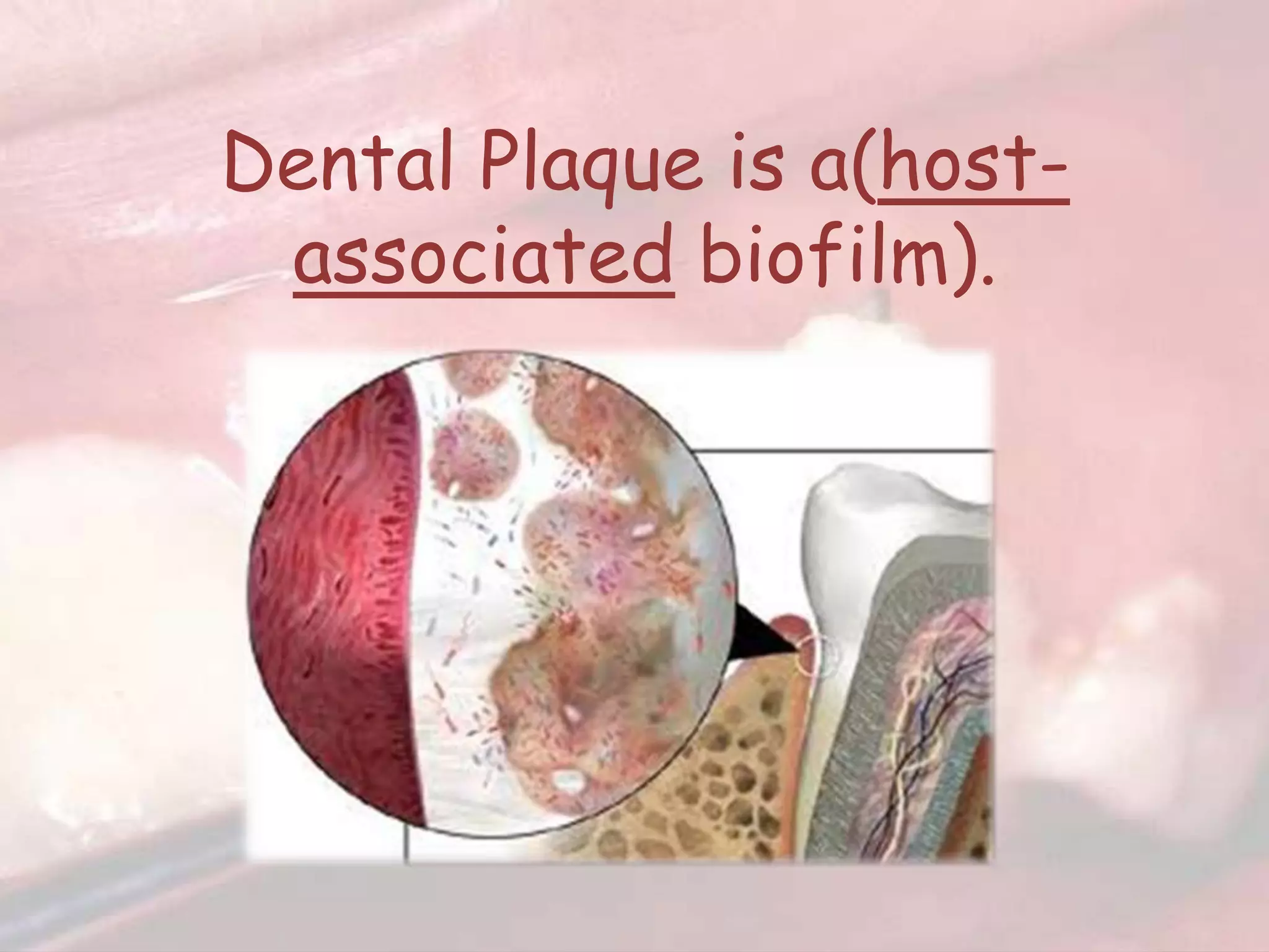 Dental plaque formation | PPTX