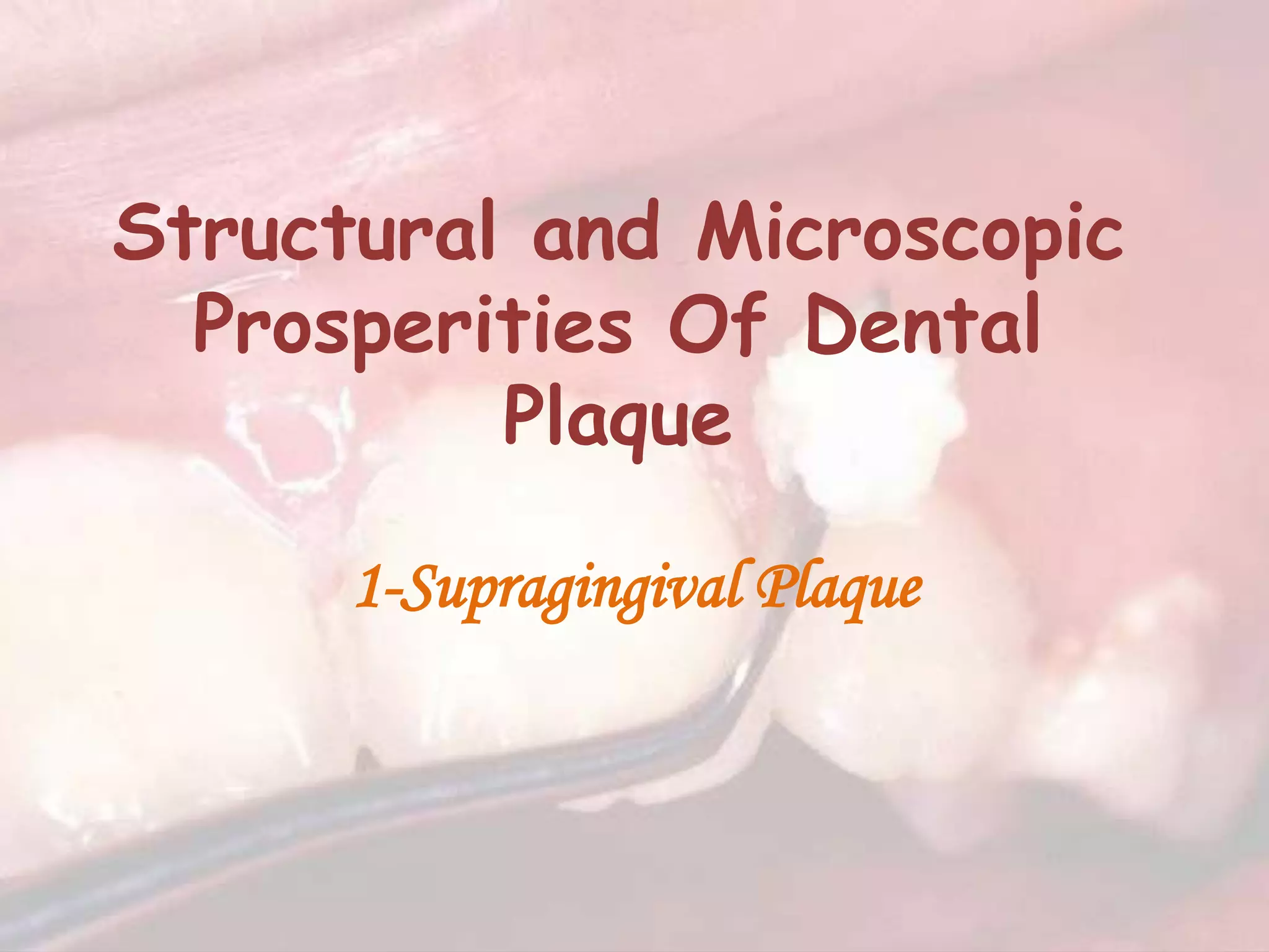 Dental plaque formation | PPTX