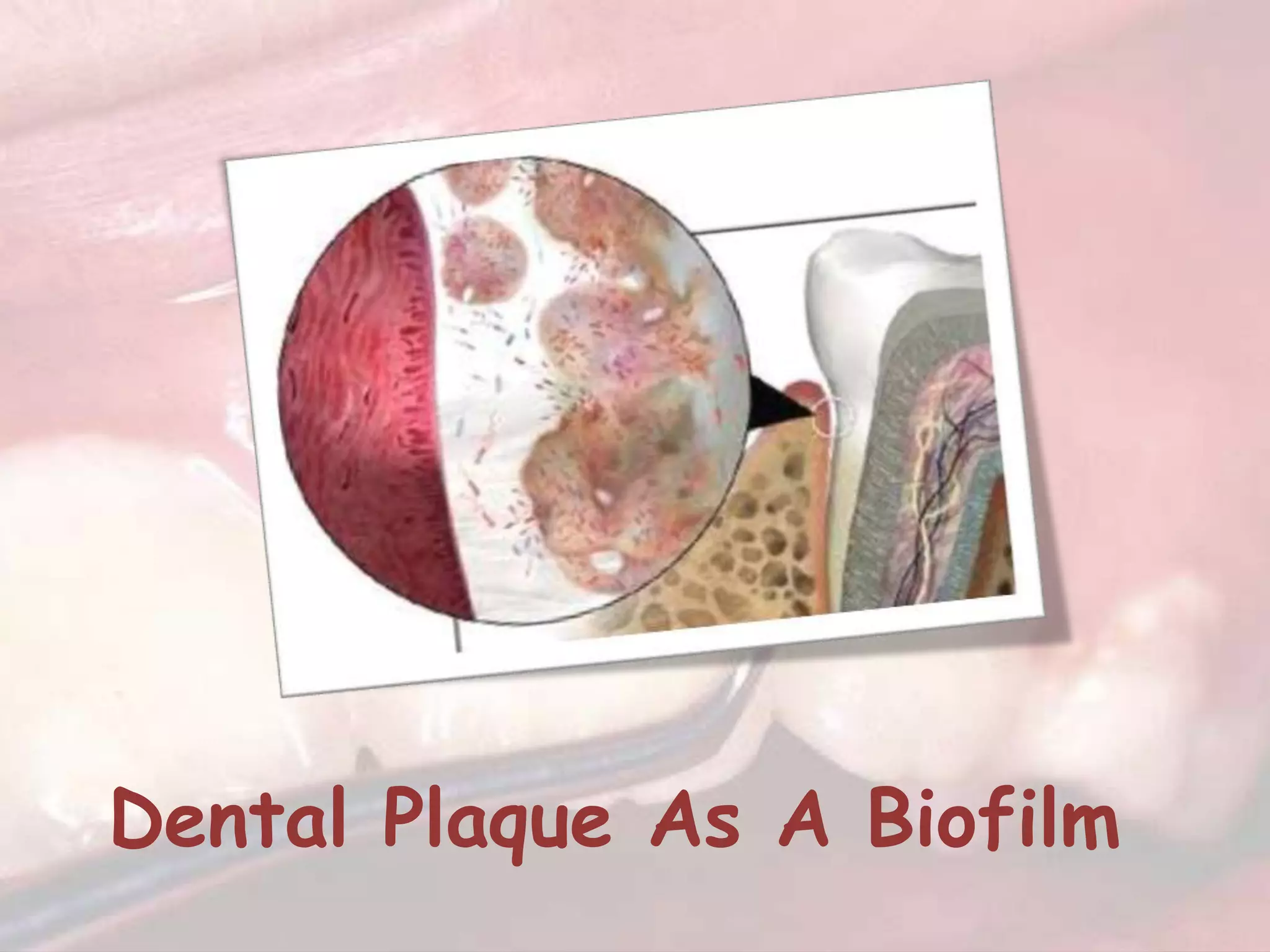 Dental plaque formation | PPTX