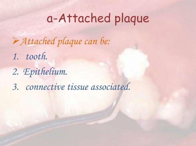 Dental plaque formation | PPTX | Oral care | Personal Care