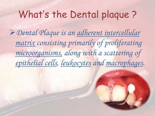 Dental plaque formation | PPTX | Oral care | Personal Care
