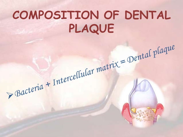 Dental plaque formation | PPTX | Oral care | Personal Care