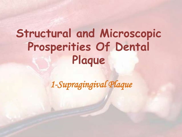 Dental plaque formation | PPTX | Oral care | Personal Care