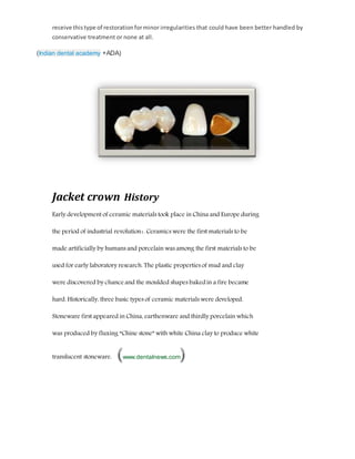 Full Crown Preparation and Some Clinical Modification PREPARION | DOCX