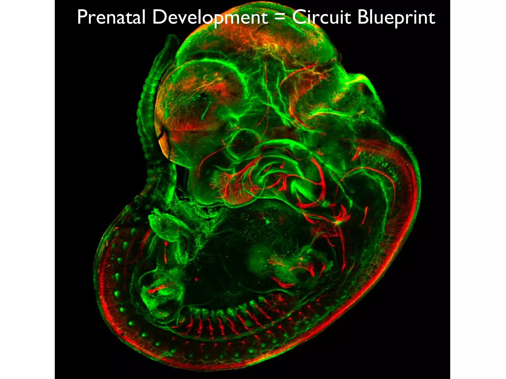 Pat Levitt: Neurodevelopmental Disorder Heterogeneity, Brain ...