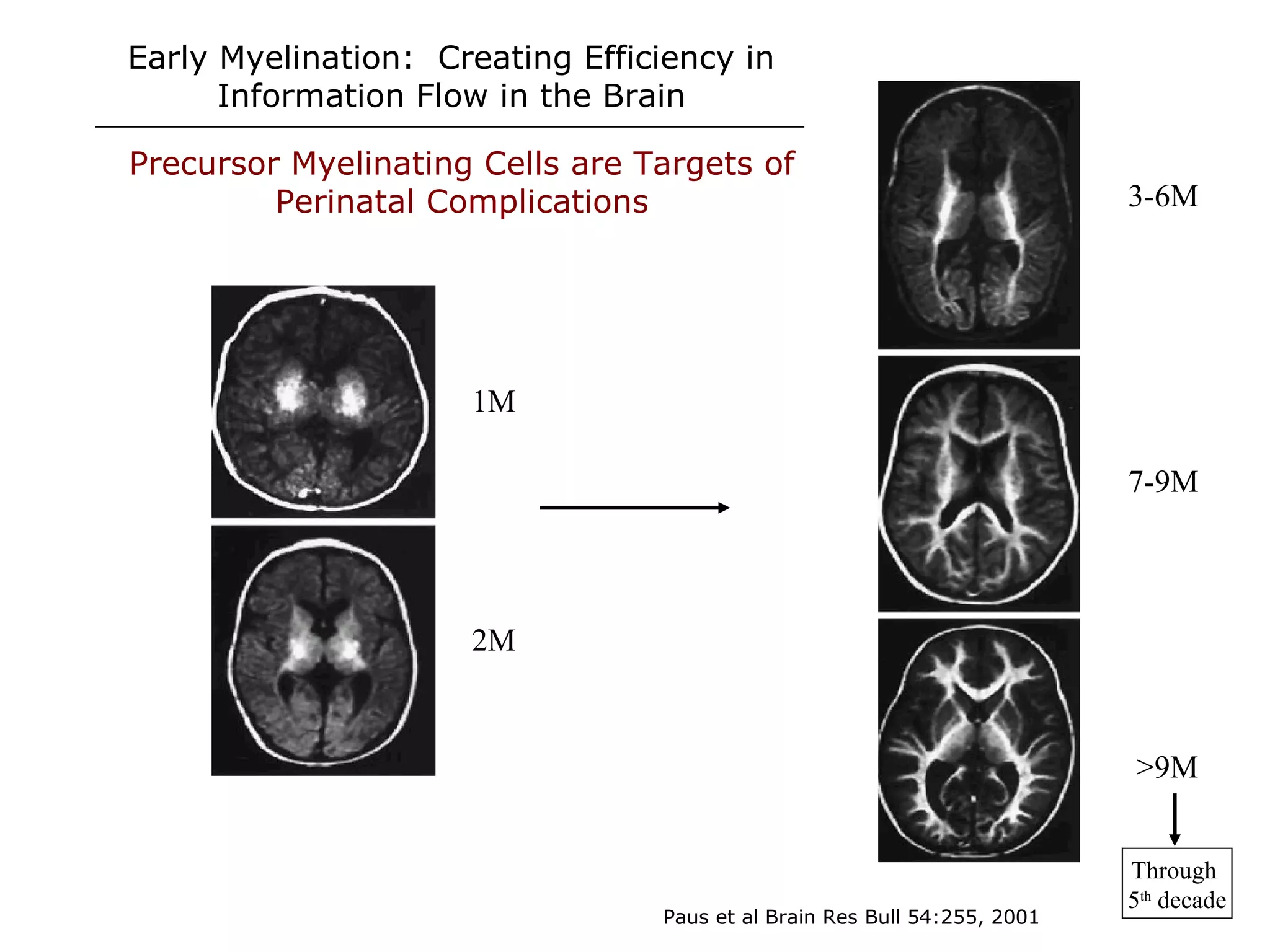 Pat Levitt: Neurodevelopmental Disorder Heterogeneity, Brain ...