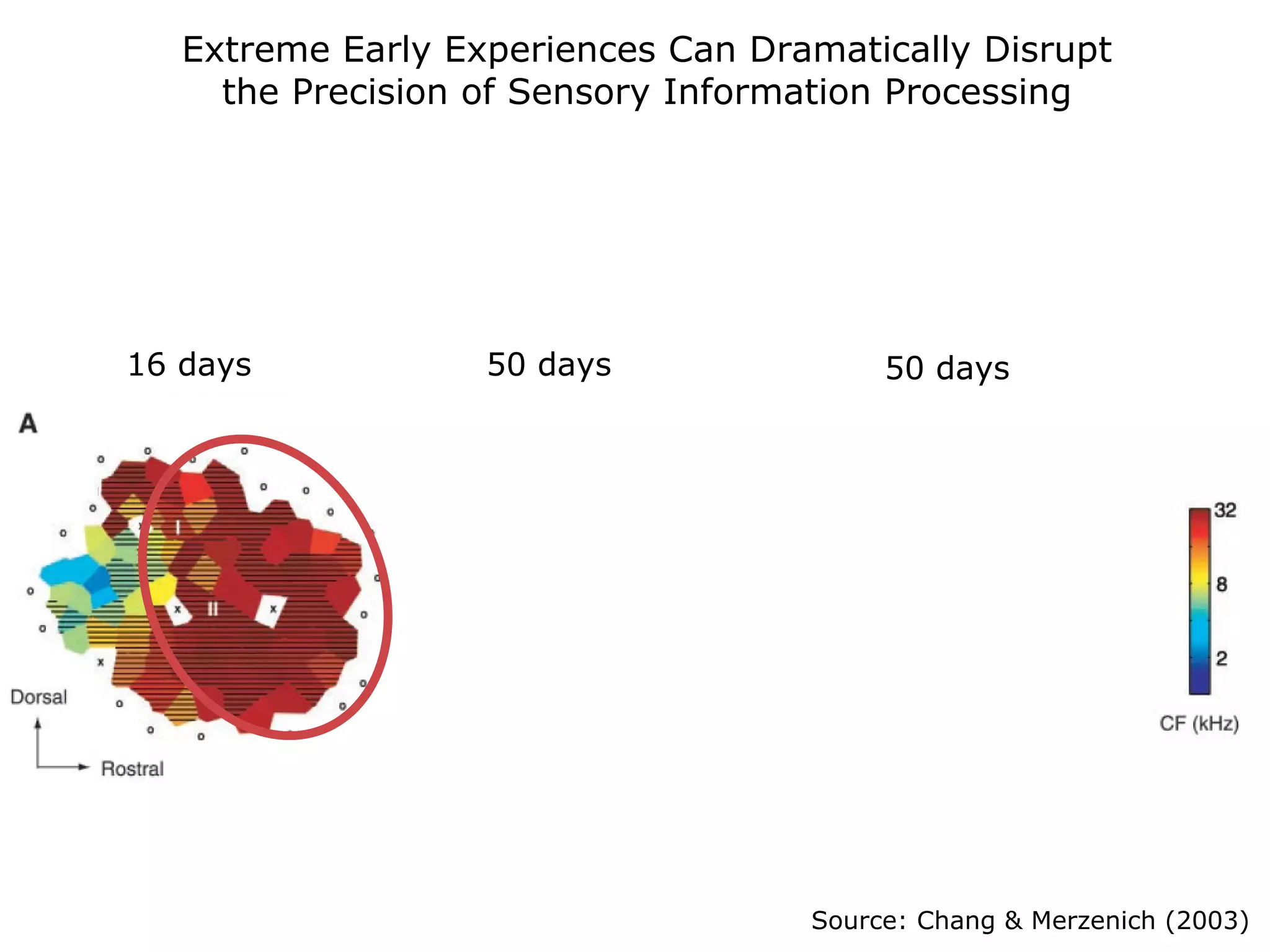 Pat Levitt: Neurodevelopmental Disorder Heterogeneity, Brain ...