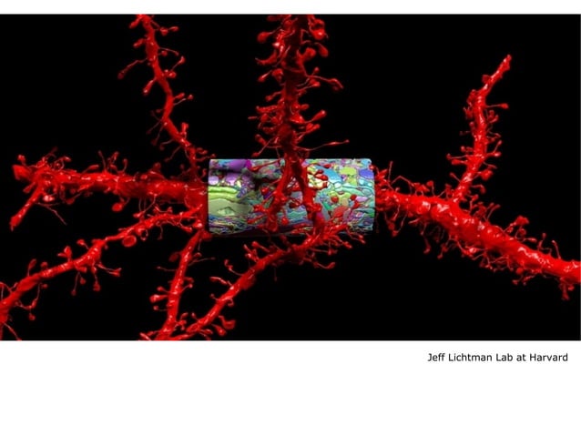 Pat Levitt: Neurodevelopmental Disorder Heterogeneity, Brain ...