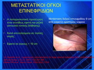 Η Λαπαροσκοπική προσέγγιση στους υπόπτους για κακοήθεια ή κακοηθείς ...