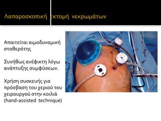Νεκρωτική παγκρεατίτιδα - χειρουργικές τεχνικές | Γιώργος Ζωγράφος ...