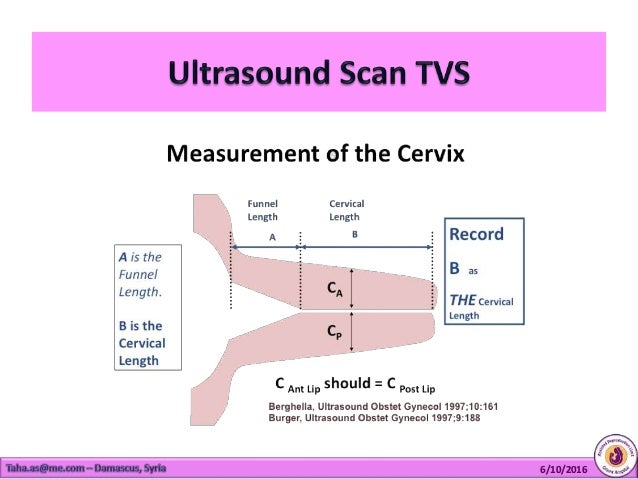 Cervical Incompetence