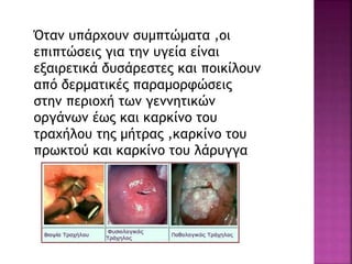 σεξουαλικώς μεταδιδόμενα νοσήματα | PPT