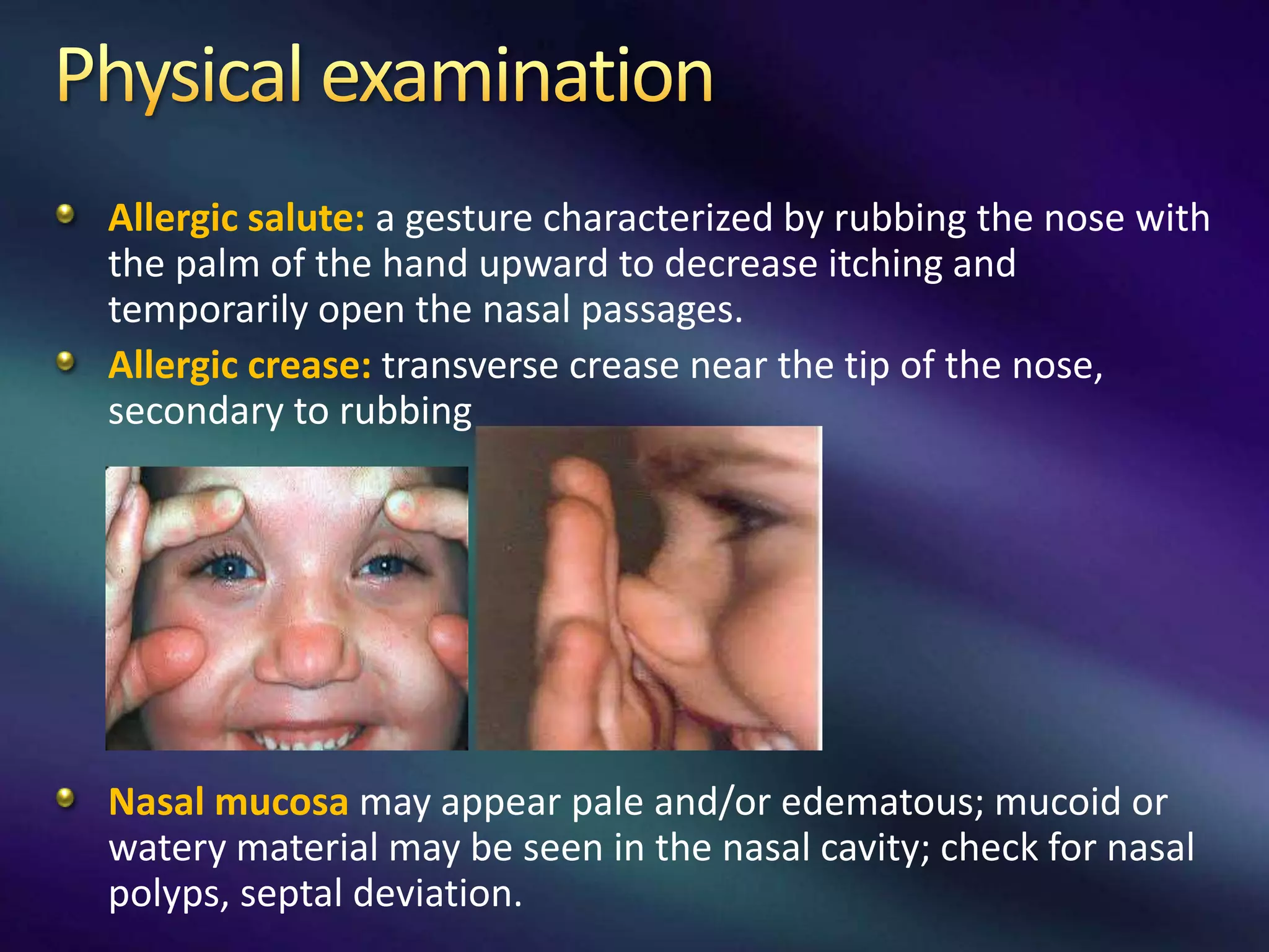 Asthma & allergic rhinitis | PPTX