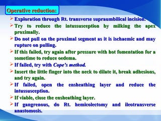 Intestinal Obstruction 2 | PPT