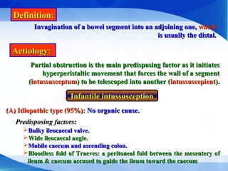 Intestinal Obstruction 2 | PPT