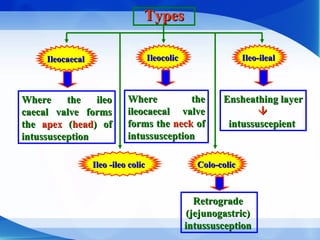 Intestinal Obstruction 2 | PPT