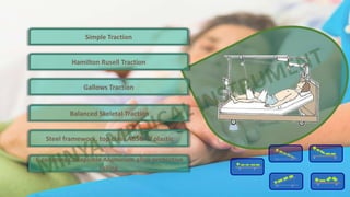 骨科牵引床 Orthopaedics Traction Bed | PPT