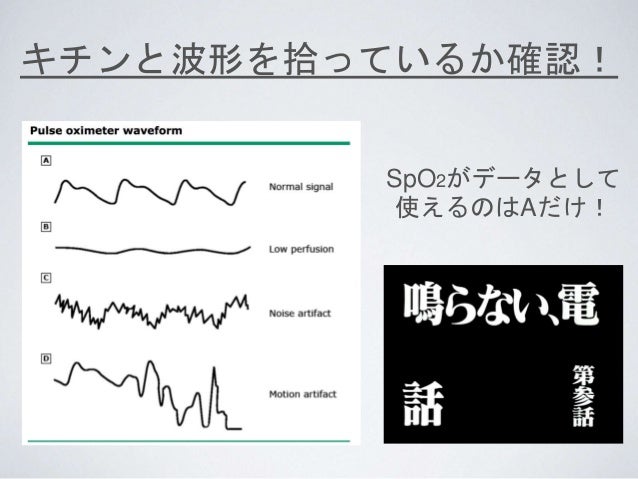 パルスオキシメーター