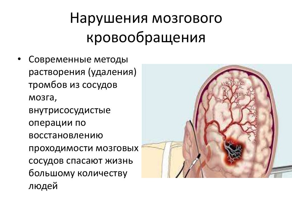 Неврология