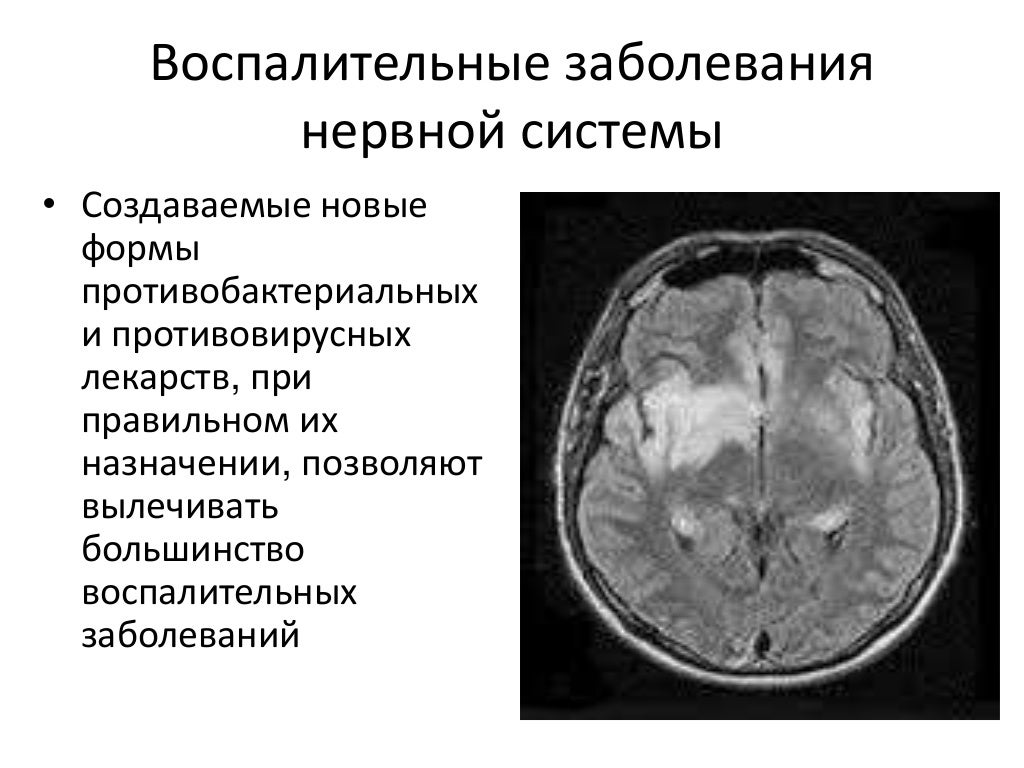 Неврология