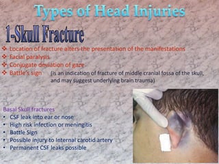 Head Injuries | PPTX