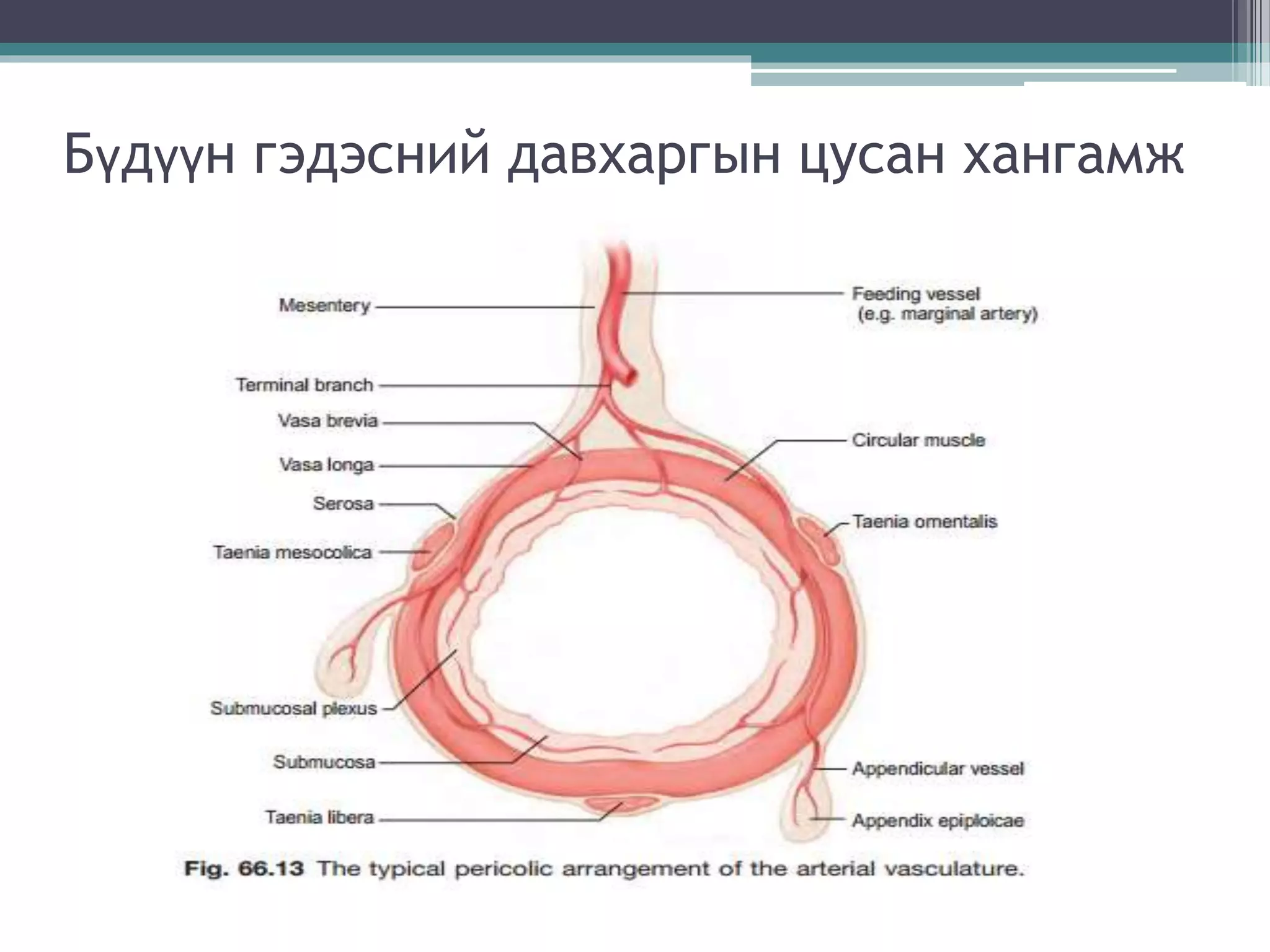 Бүдүүн гэдэсний хорт хавдар Pptx