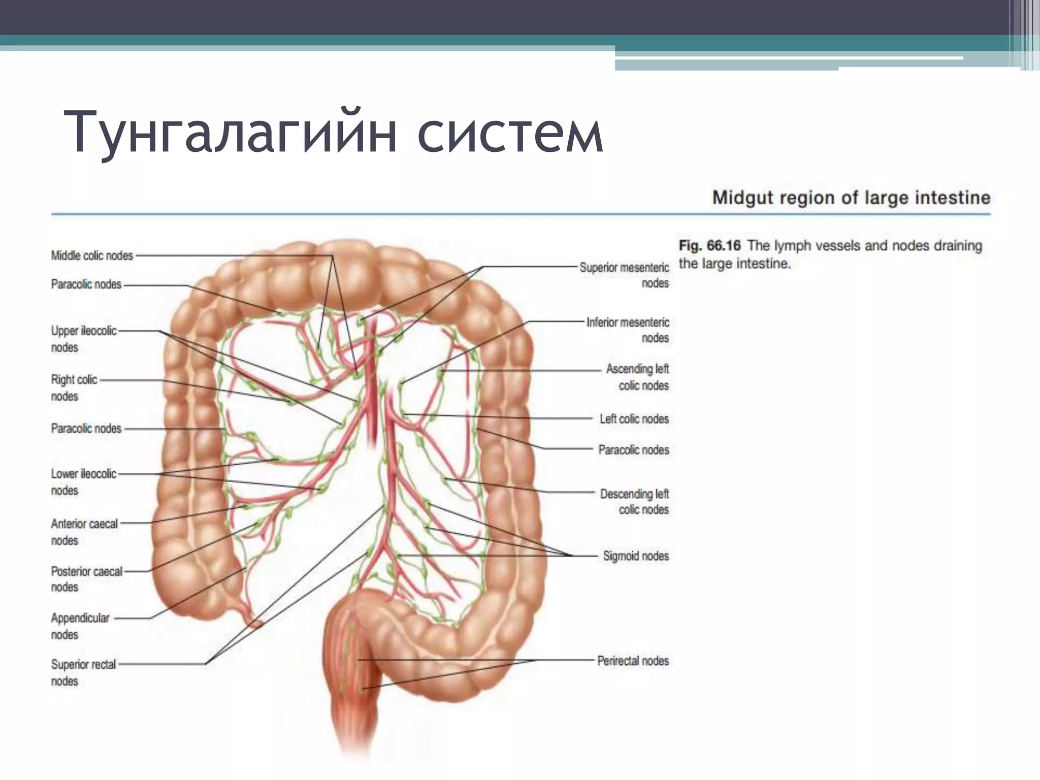 Бүдүүн гэдэсний хорт хавдар Pptx