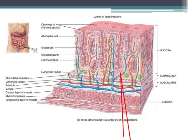 Бүдүүн гэдэсний хорт хавдар Pptx