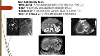 liver cirrhosis | PDF