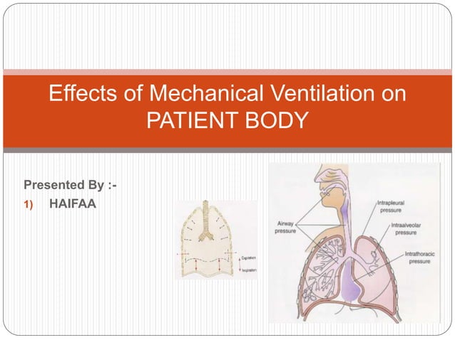 Effects of Mechanical Ventilation on PATIENT BODY | PPTX | Heart and ...