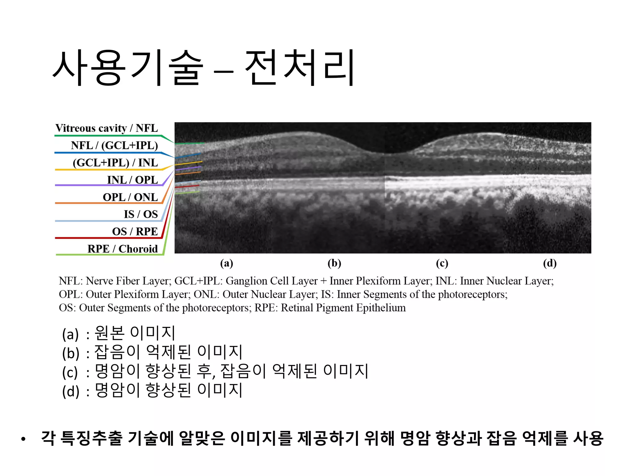 retinal layer segmentation | PDF