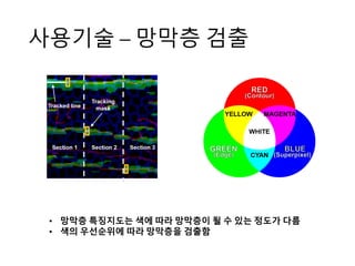 retinal layer segmentation | PDF
