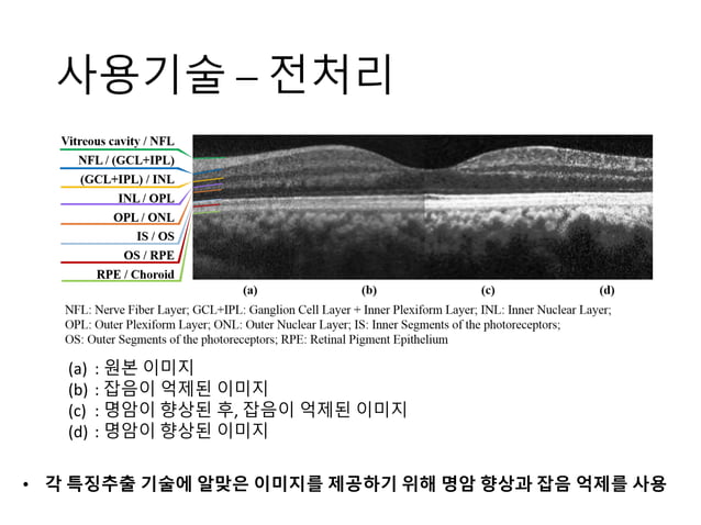 retinal layer segmentation | PDF