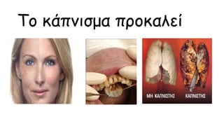 παρουσιαση για το καπνισμα | ODP