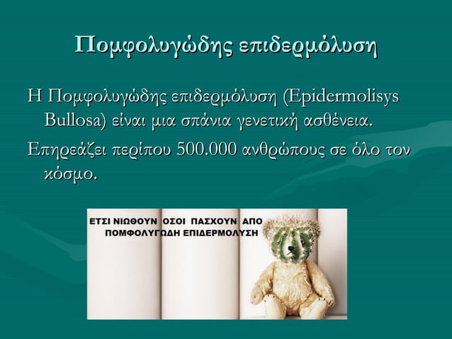πομφολυγώδης επιδερμόλυση | PPT