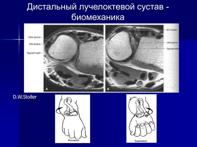 Лучевая диагностика в ортопедии и травматологии | PPT