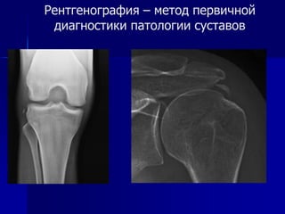 Лучевая диагностика в ортопедии и травматологии | PPT