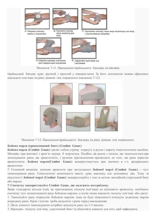 ЗУПИНКА КРОВОТЕЧІ БЕЗ НАКЛАДЕННЯ ДЖГУТА Забезпечте доступ до рани | PDF