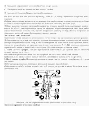 ЗУПИНКА КРОВОТЕЧІ БЕЗ НАКЛАДЕННЯ ДЖГУТА Забезпечте доступ до рани | PDF